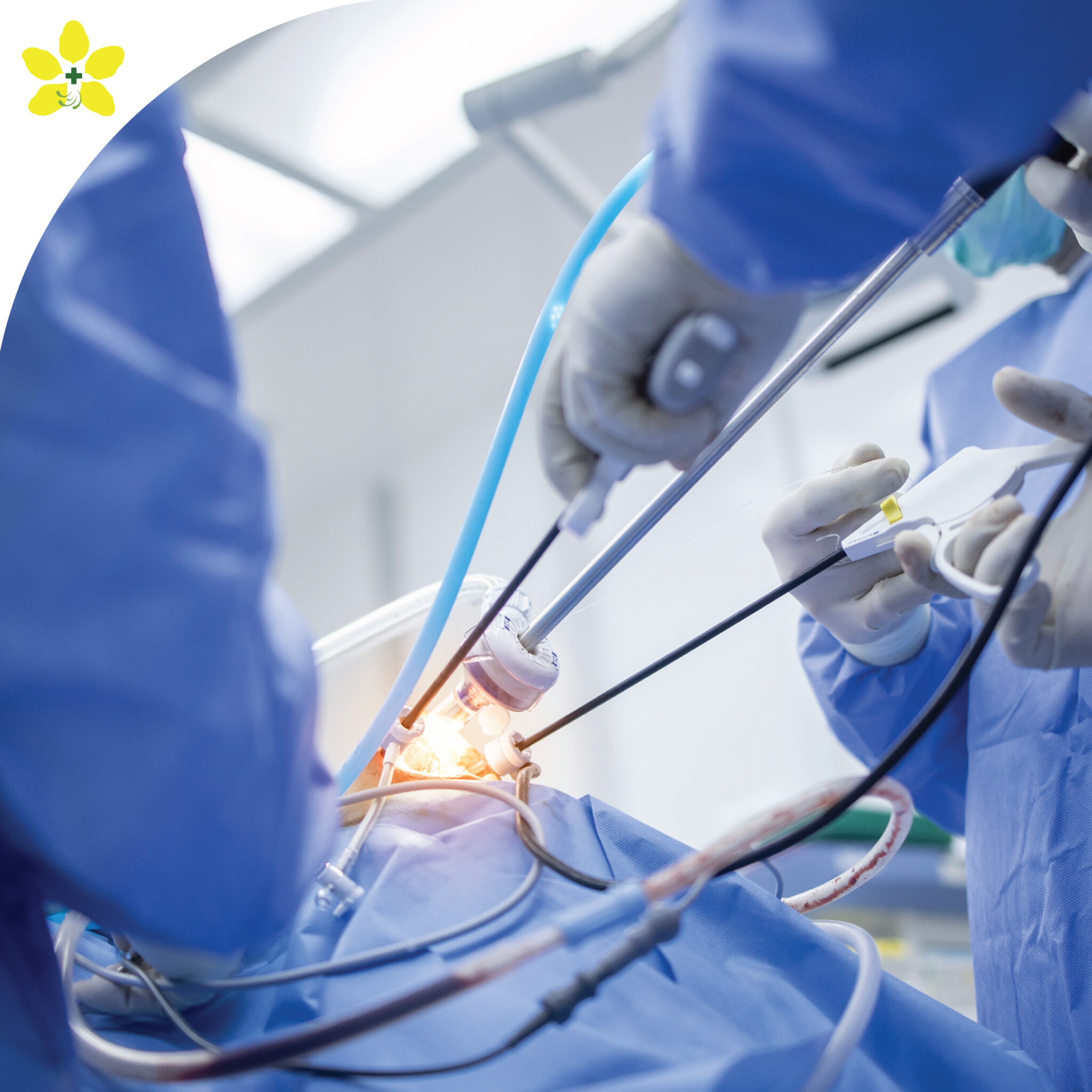 Laparoscopic Appendectomy Package - 拉查普魯克醫院