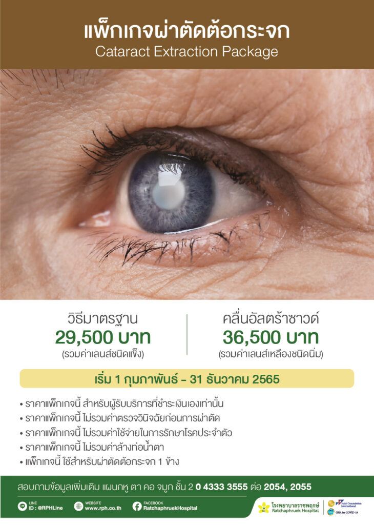 Cataract Extraction Package - Ratchaphruek Hospital